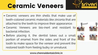 Ceramic veneers And it's Benefits | PDF