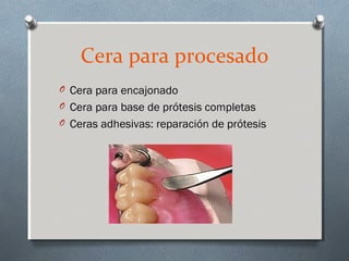 Ceras dentales | PPT