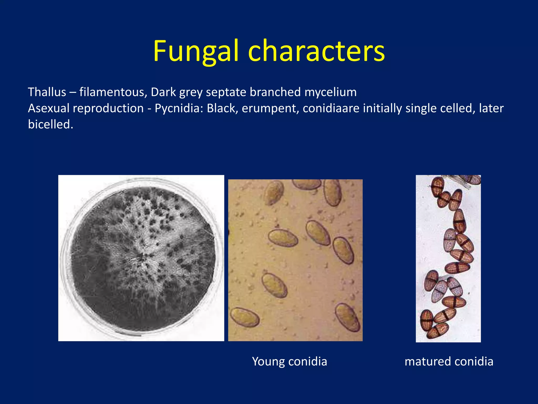 Ceratocystis, Colletotrichum, Botryodiplodia&Magnaporthe.pptx