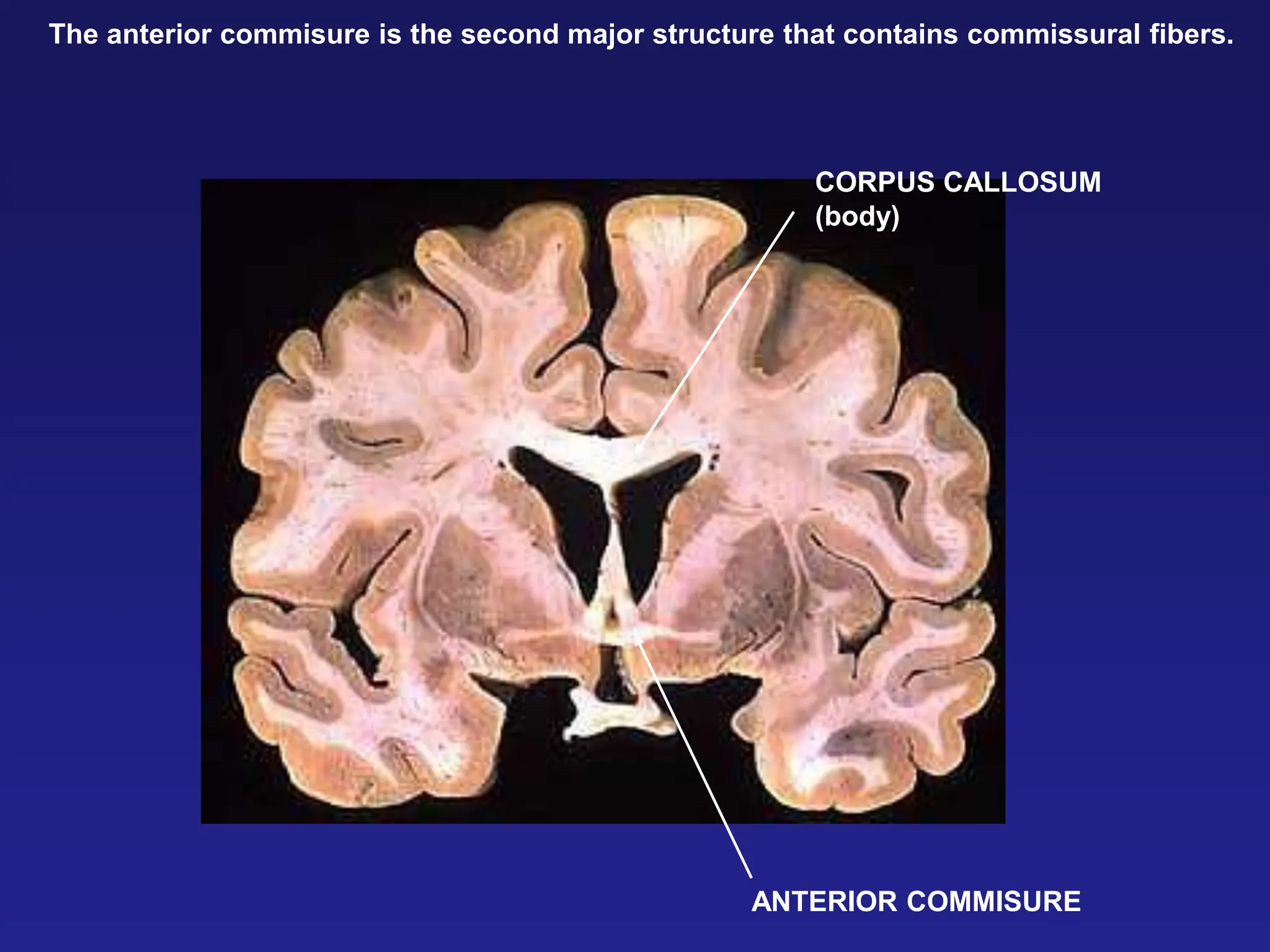 physiology of cerebral cortex, cerbral cortex.ppt