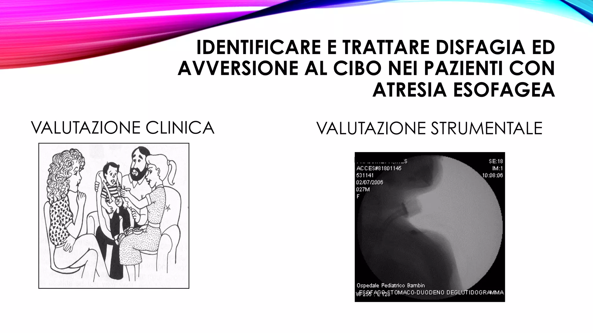 Atresia Esofagea - Disfagia e avversione al cibo | PDF