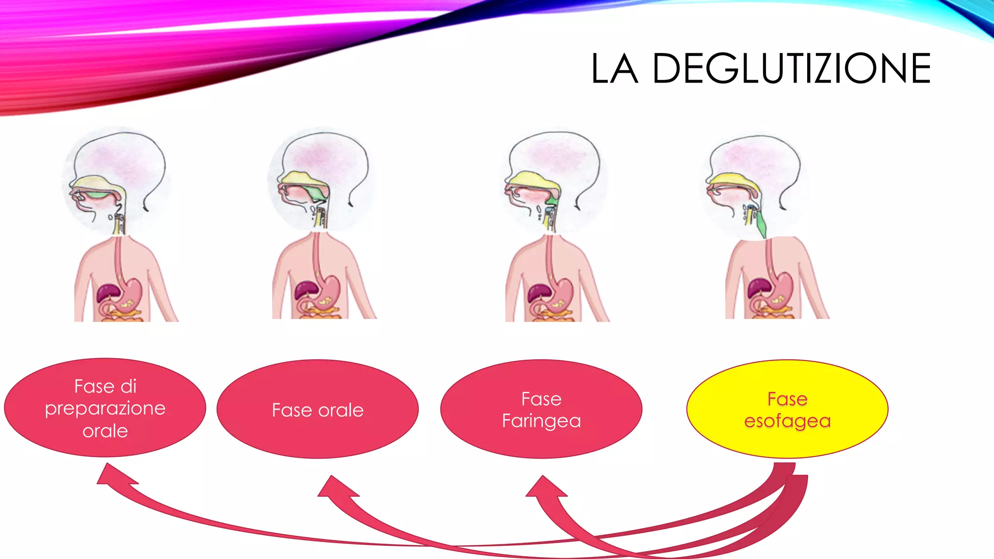 Atresia Esofagea - Disfagia e avversione al cibo | PDF