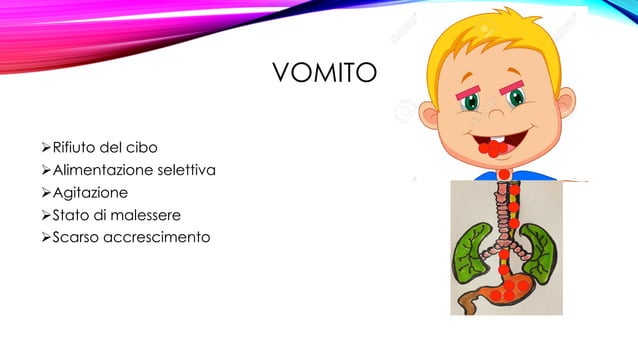 Atresia Esofagea - Disfagia e avversione al cibo | PDF