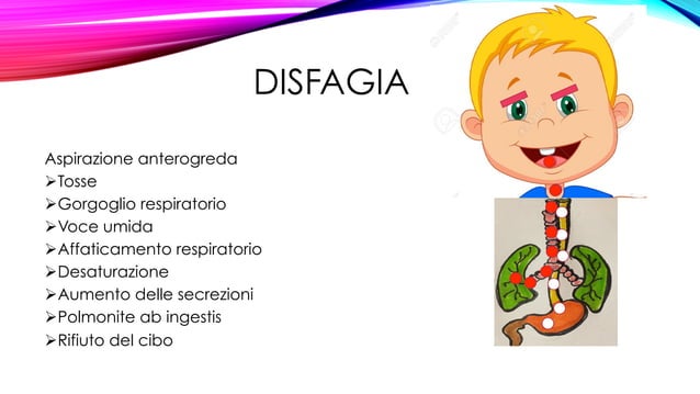 Atresia Esofagea - Disfagia e avversione al cibo | PDF