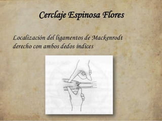Cerclaje | PPTX