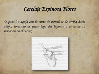 Cerclaje | PPTX