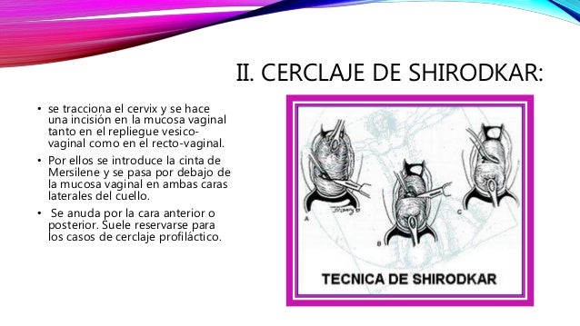 Cerclaje cervical
