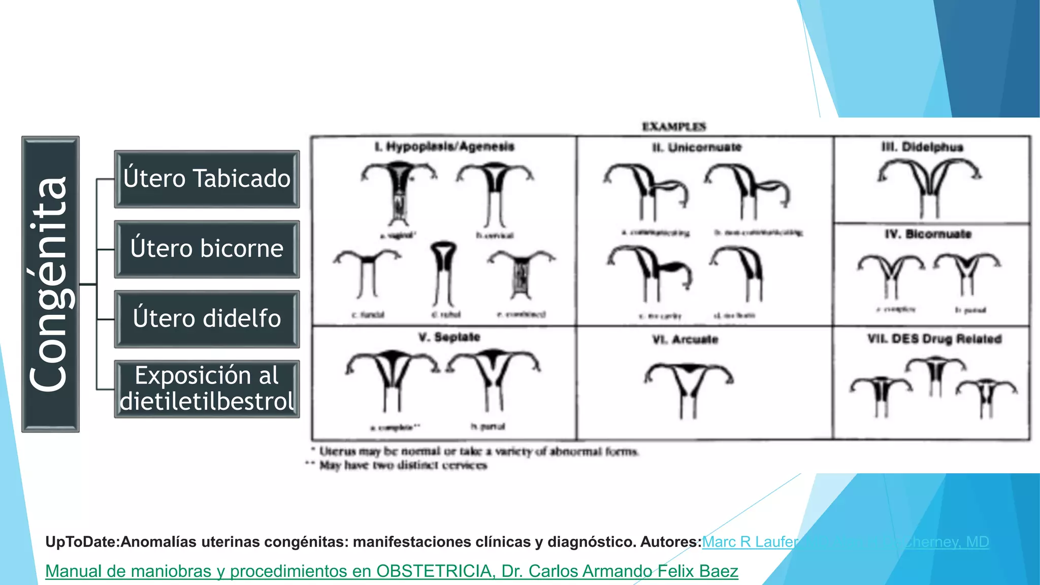 Cerclaje cervical | PPTX