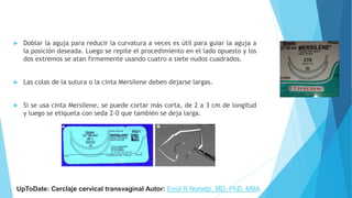 Cerclaje cervical | PPTX