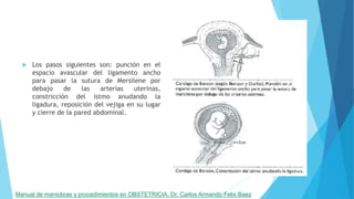 Cerclaje cervical | PPTX