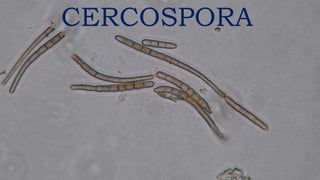 Cercospora & virus | PPTX