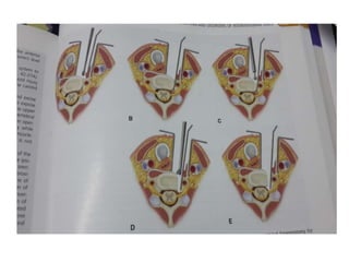 Cer disc | PPTX