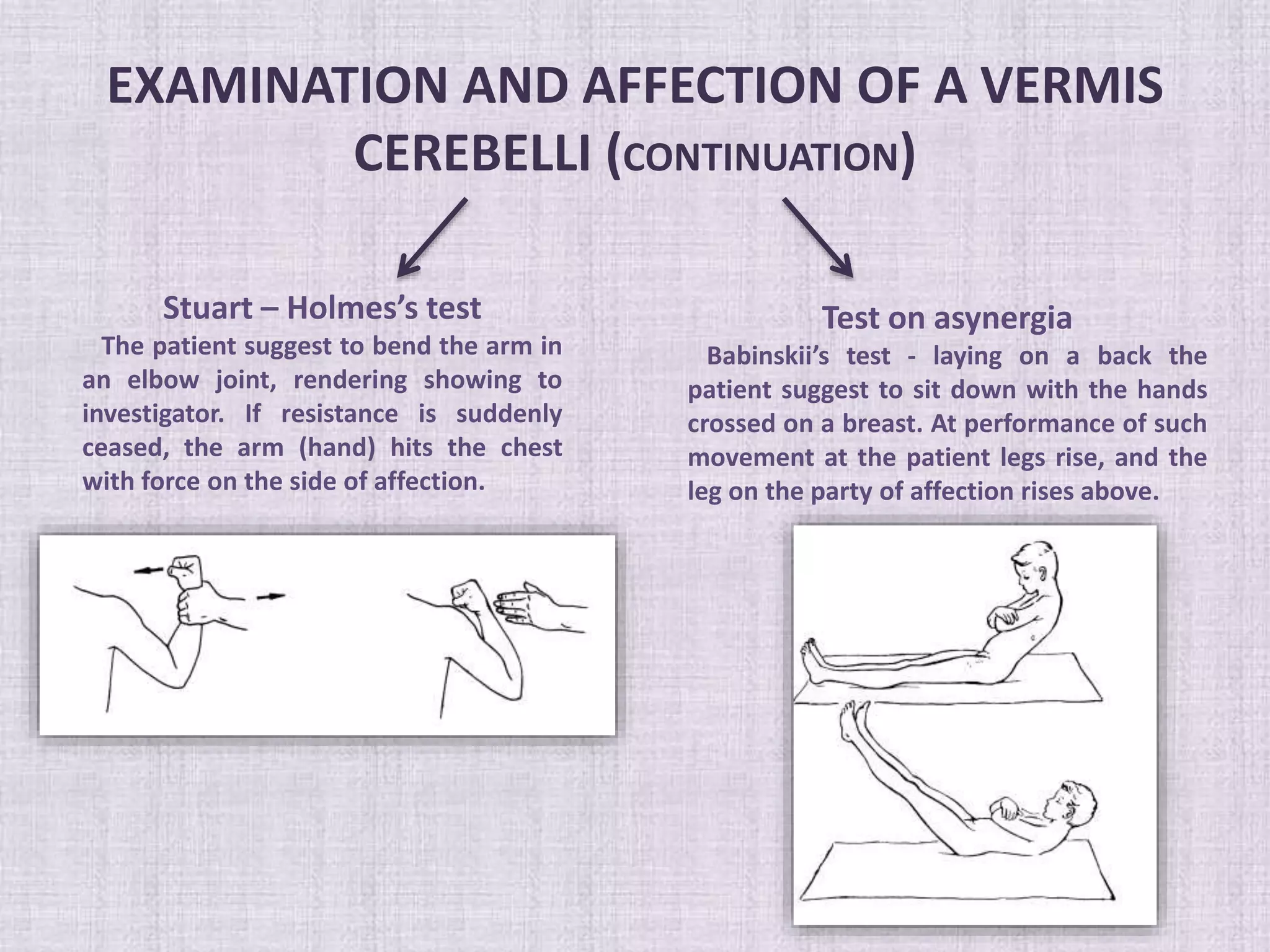 Cerebellum (Neurology 3) | PPT