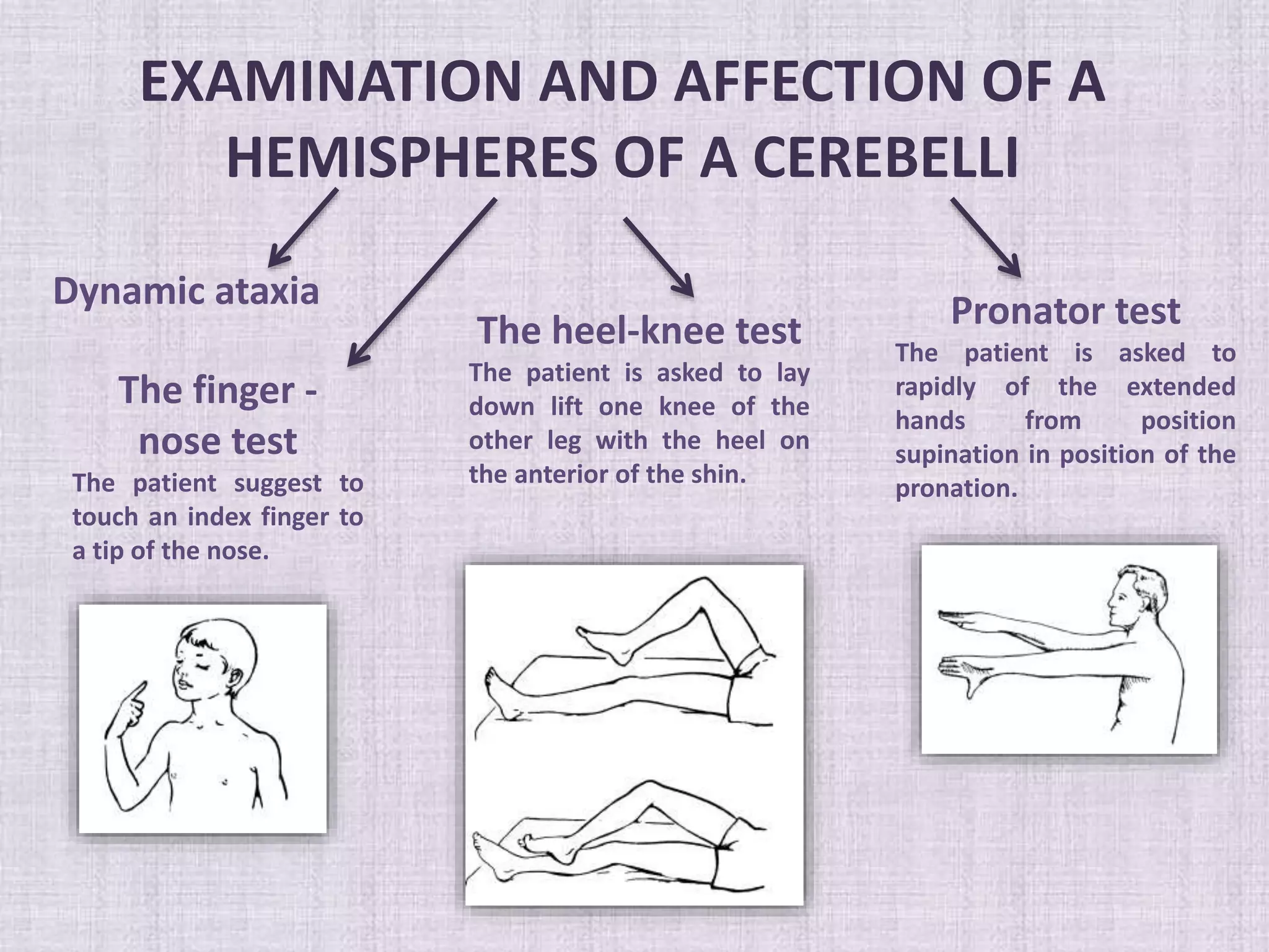 Cerebellum (Neurology 3) | PPT