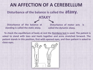Cerebellum (Neurology 3) | PPT