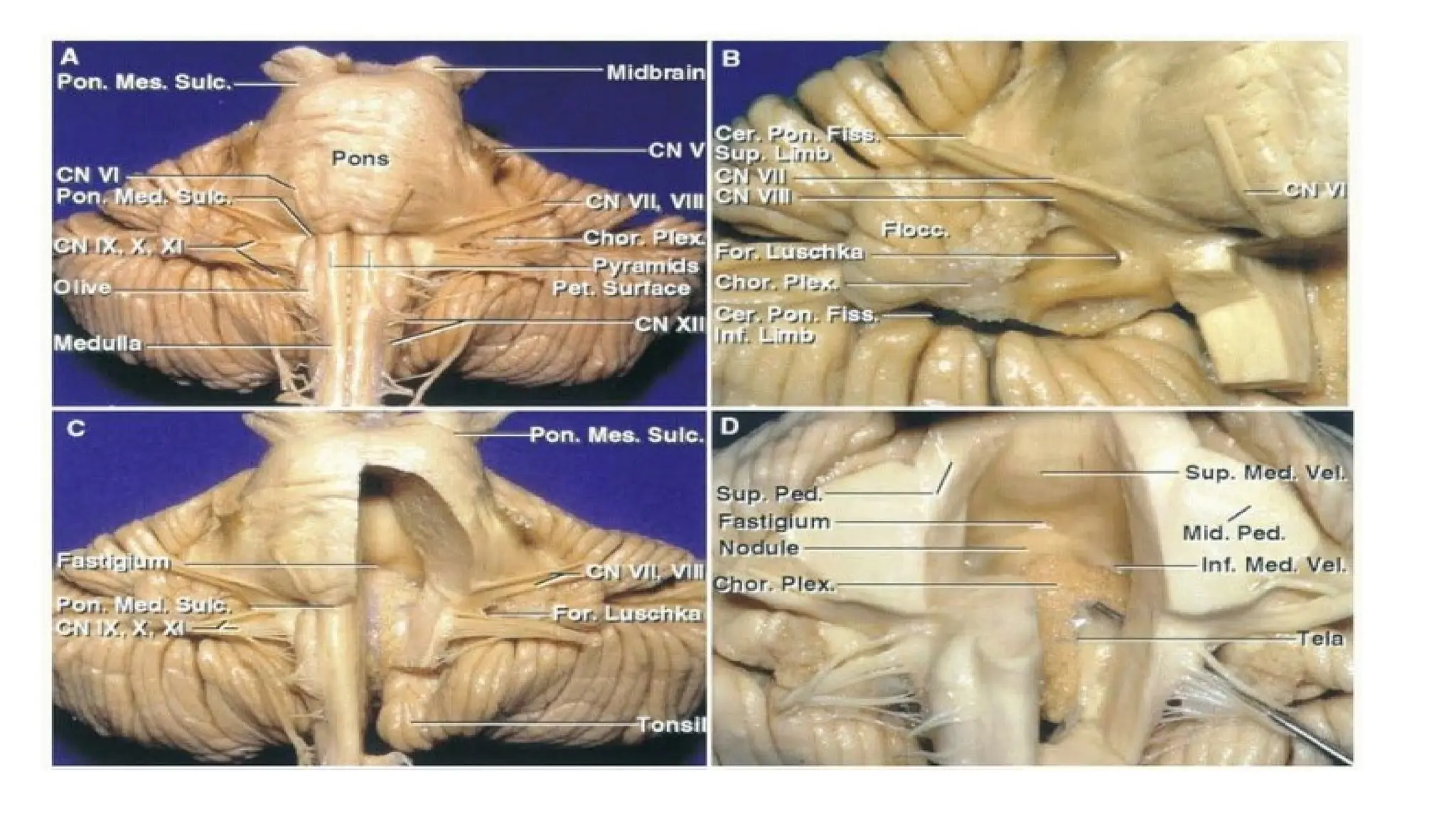 cerebellar anatomy and physiology mictrosurgical anatomy and approches ...