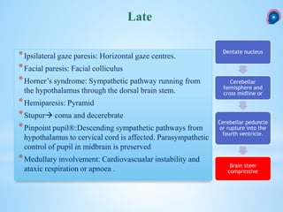 Cerebellar haematoma | PPTX