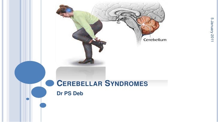 Cerebellar syndromes