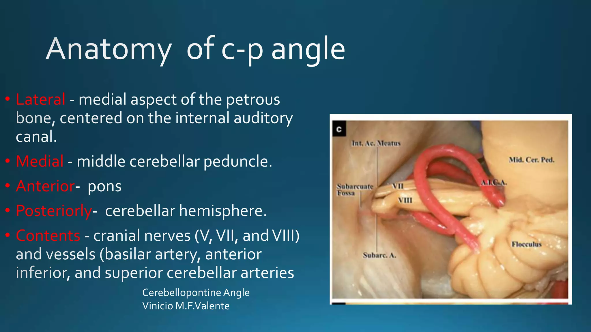 Cerebellopontine angle tumours | PPTX