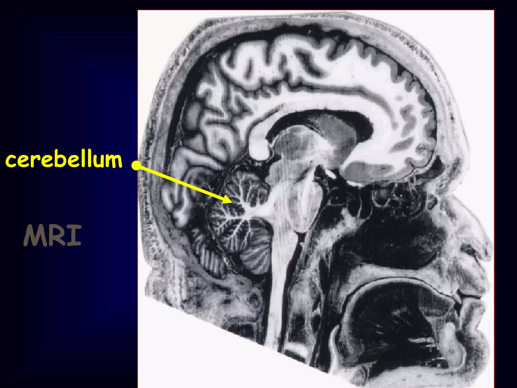 Cerebellum | PPT