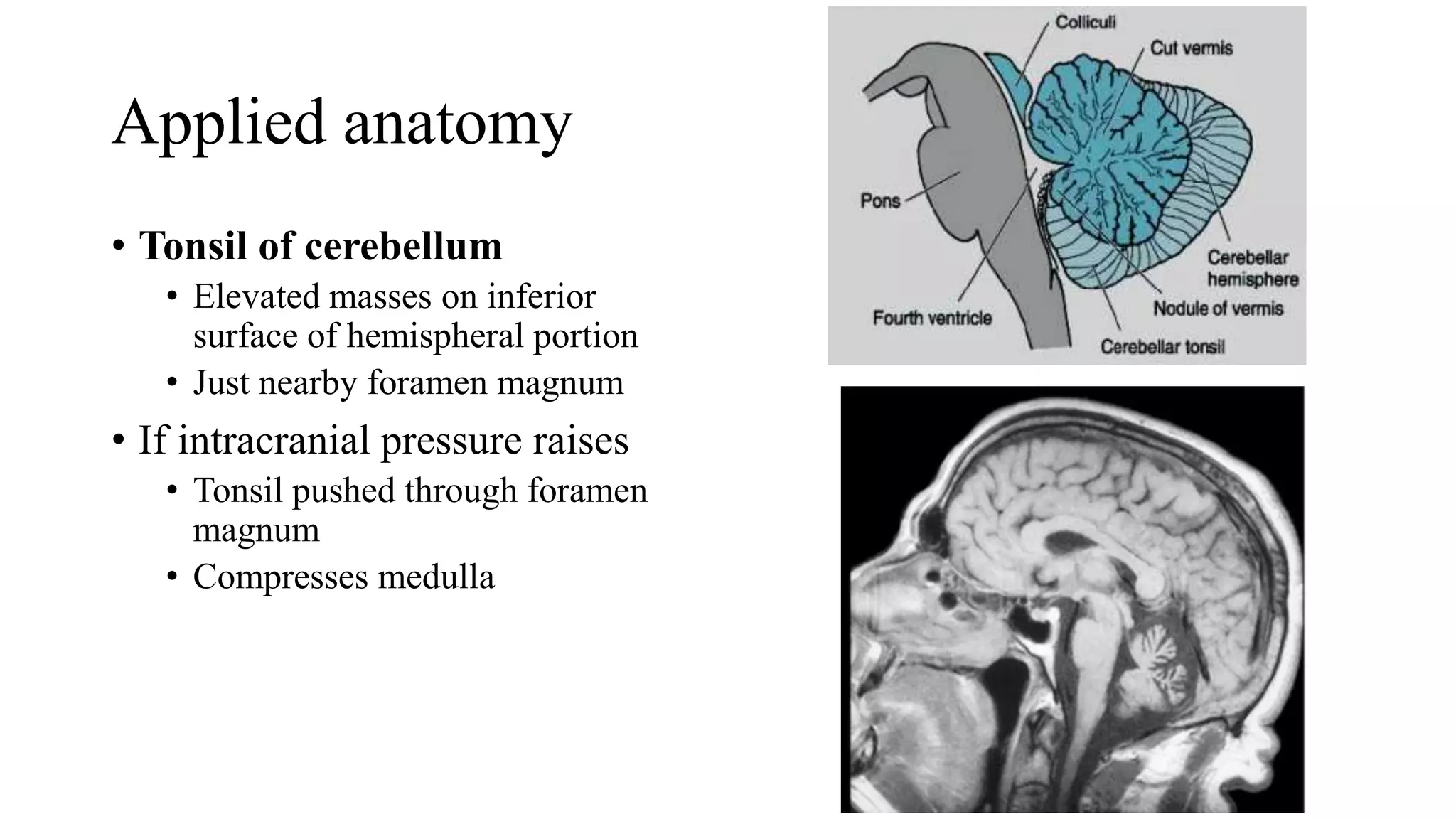 cerebellum.pptx