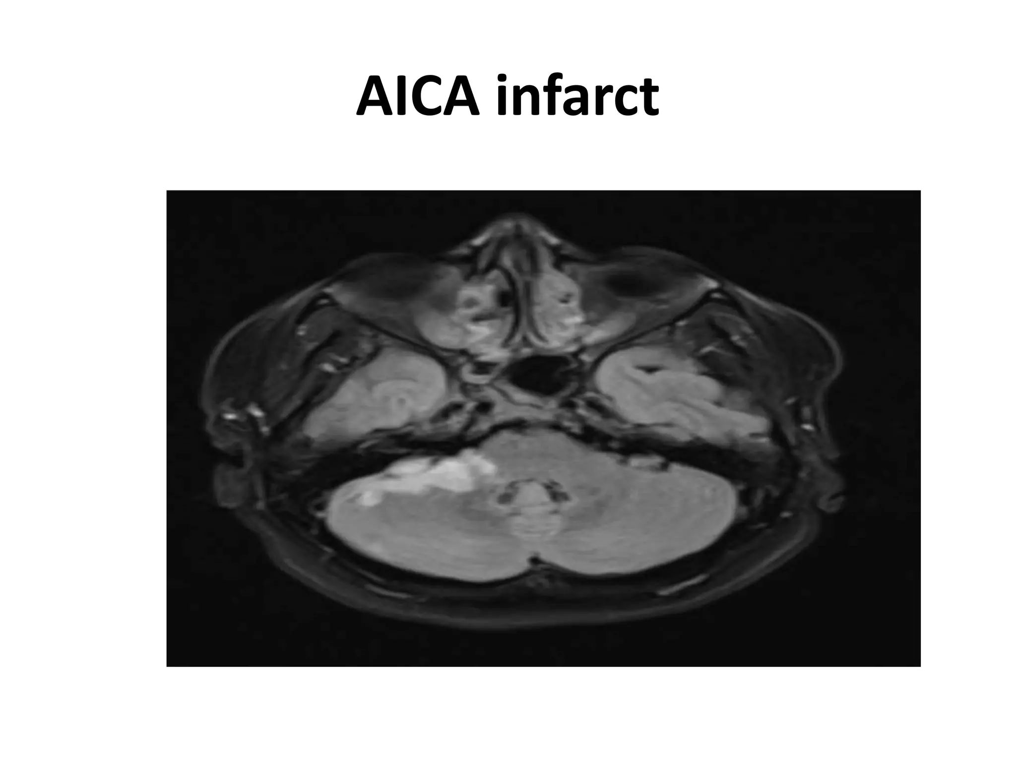 Cerebellum and its connections | PPTX