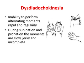 Cerebellum applied anatomy | PPTX