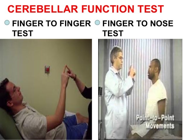 Cerebellum by suresh aadi8888