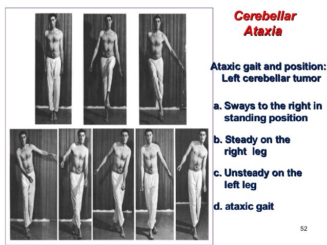 Cerebellum by suresh aadi8888