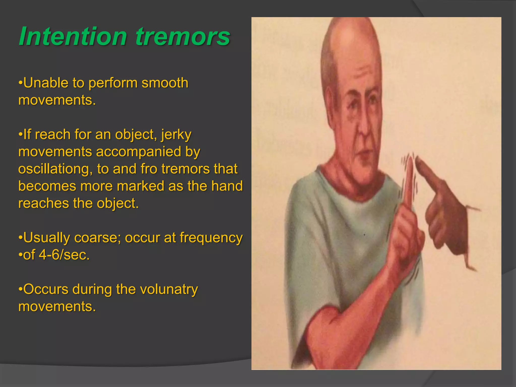 Cerebellum ppt | PPTX
