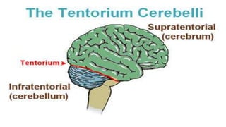 Cerebellum Pharm D.pptx
