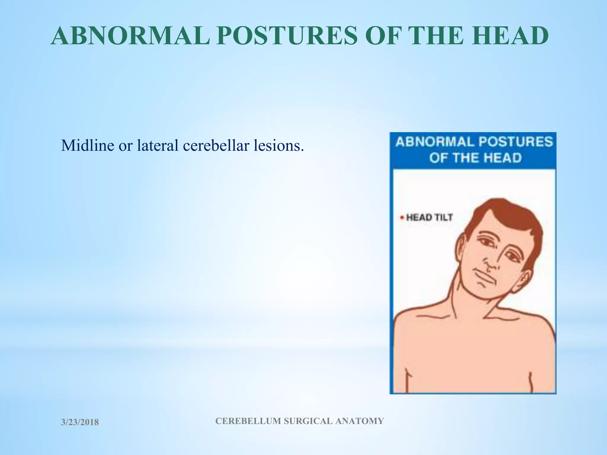 Cerebellum surgical anatomy | PPTX
