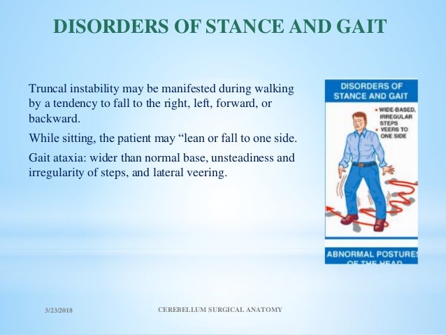 Cerebellum surgical anatomy