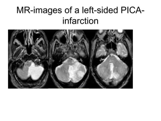 doctorCerebelum applied | PPT