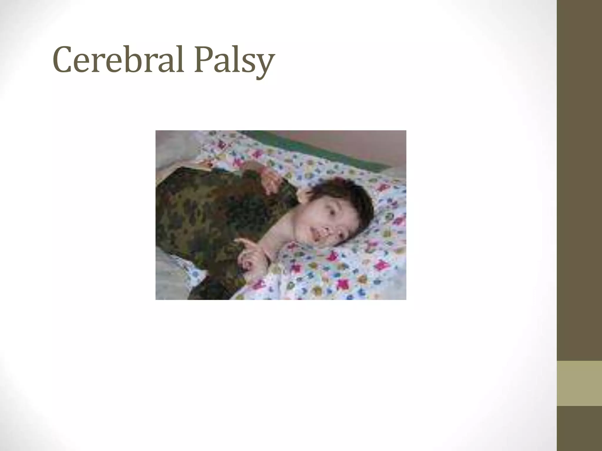 cereble palsy.ppt
