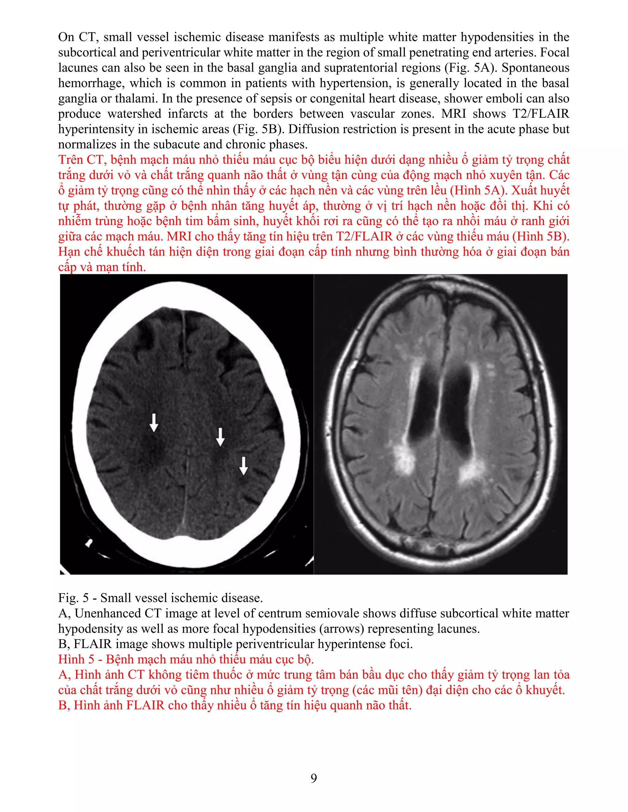 Cerebral-Edema-Phu-nao.pdf
