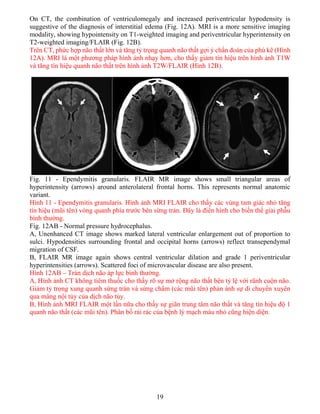Cerebral-Edema-Phu-nao.pdf