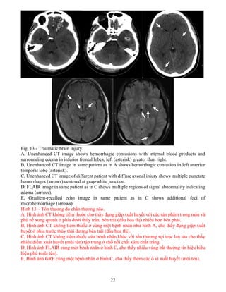 Cerebral-Edema-Phu-nao.pdf