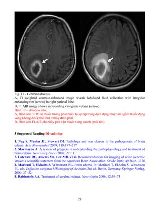 Cerebral-Edema-Phu-nao.pdf