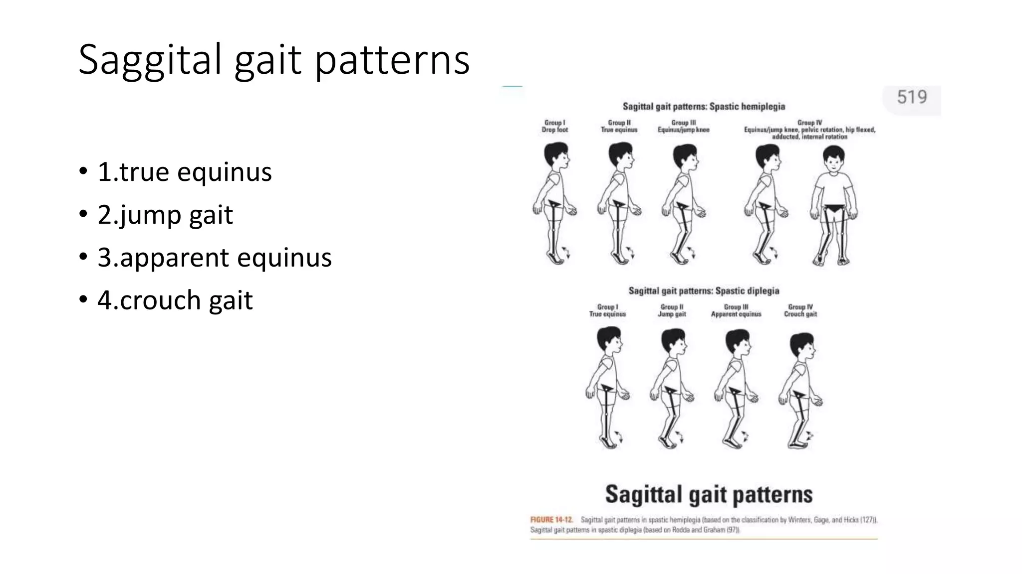 Cerebral%20palsy%20(1).pptx