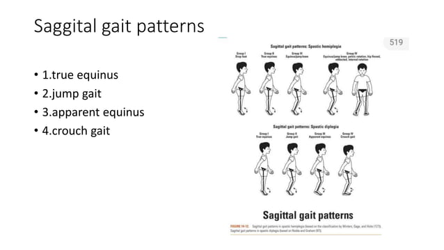 Cerebral%20palsy%20(1).pptx