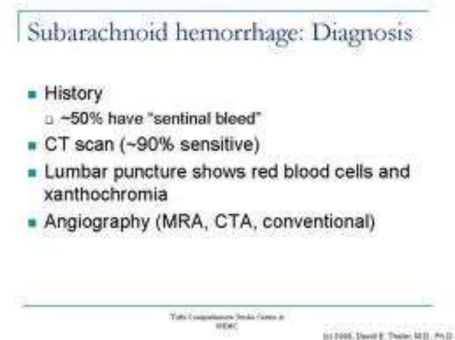 Cerebral Aneursym & Subarachnoid Haemorrhage | PPT