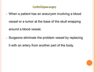 Aneurysms | PPT