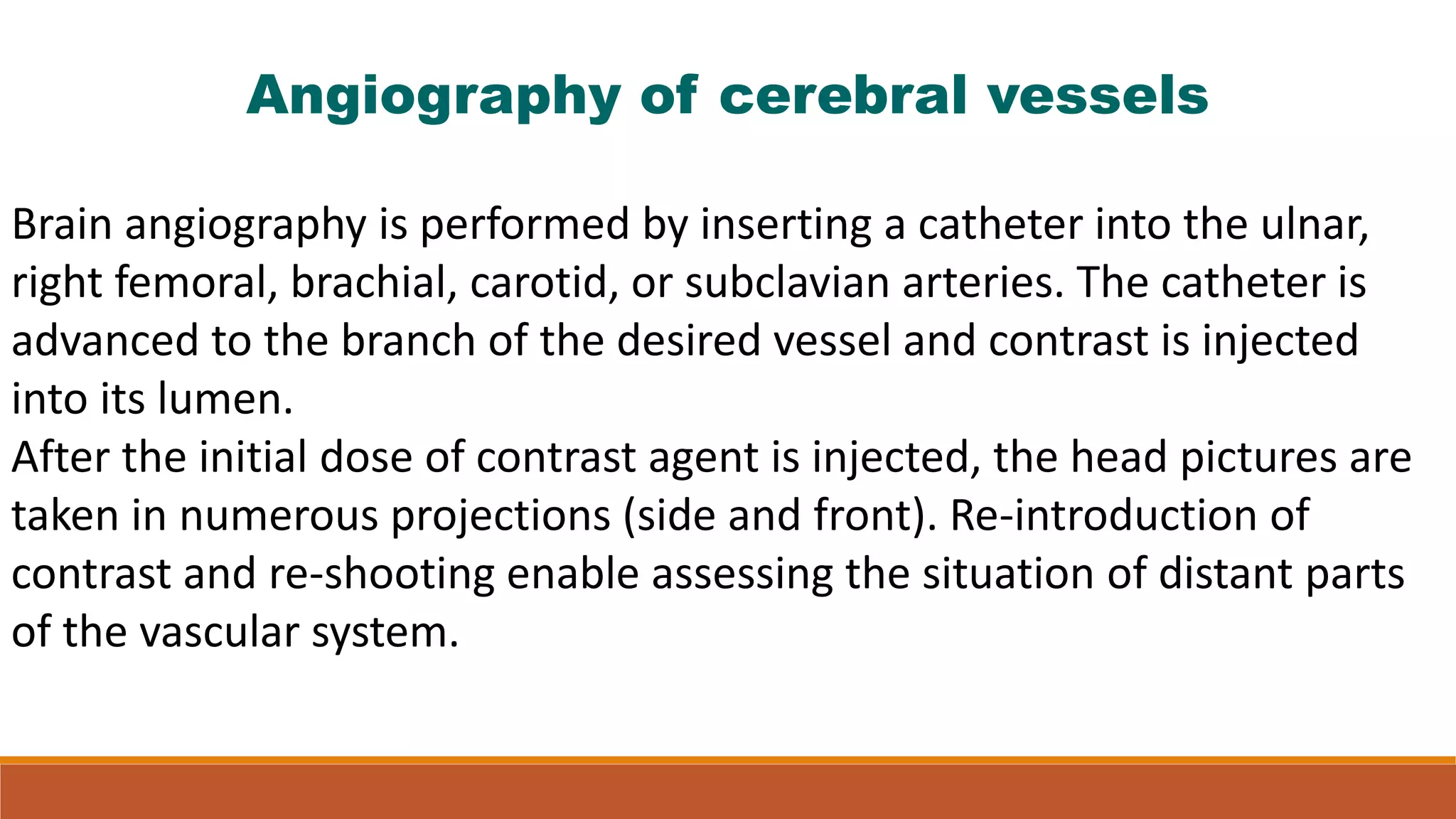 Cerebral angiography - medical information | PPTX