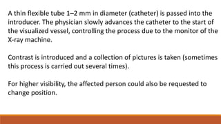 Cerebral angiography - medical information | PPTX