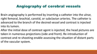 Cerebral angiography - medical information | PPTX