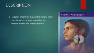 CEREBRAL ANGIOGRAPHY.pptx
