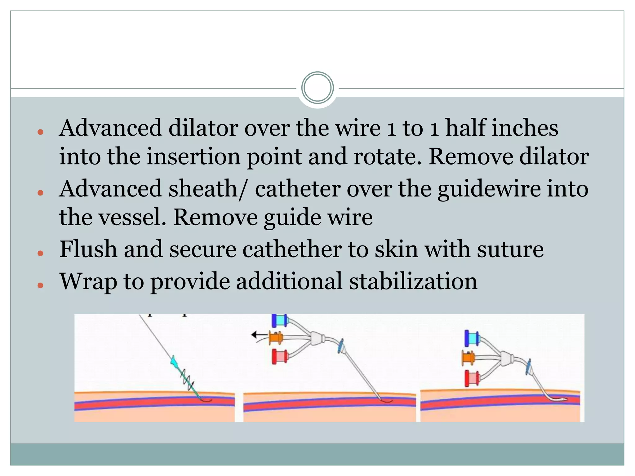 Cerebral angiography procedure | PPTX