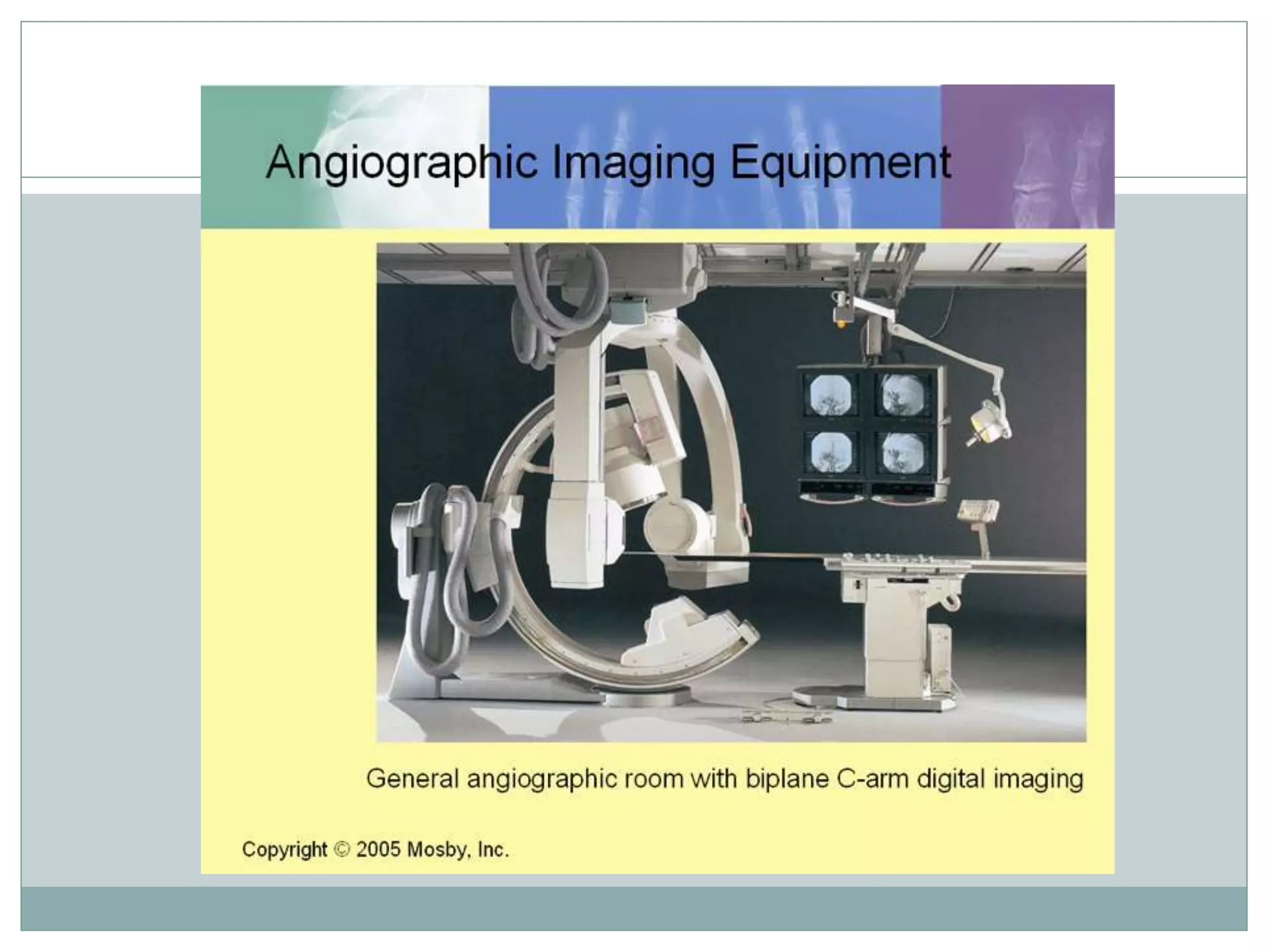 Cerebral angiography procedure | PPTX