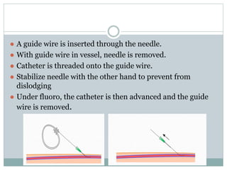 Cerebral angiography procedure | PPTX | First Aid | Injuries